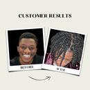 17BLEND Hair Growth Follicle Stimulator Oil | Issa Miracle