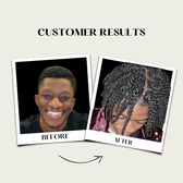 17BLEND Hair Growth Follicle Stimulator Oil | Issa Miracle